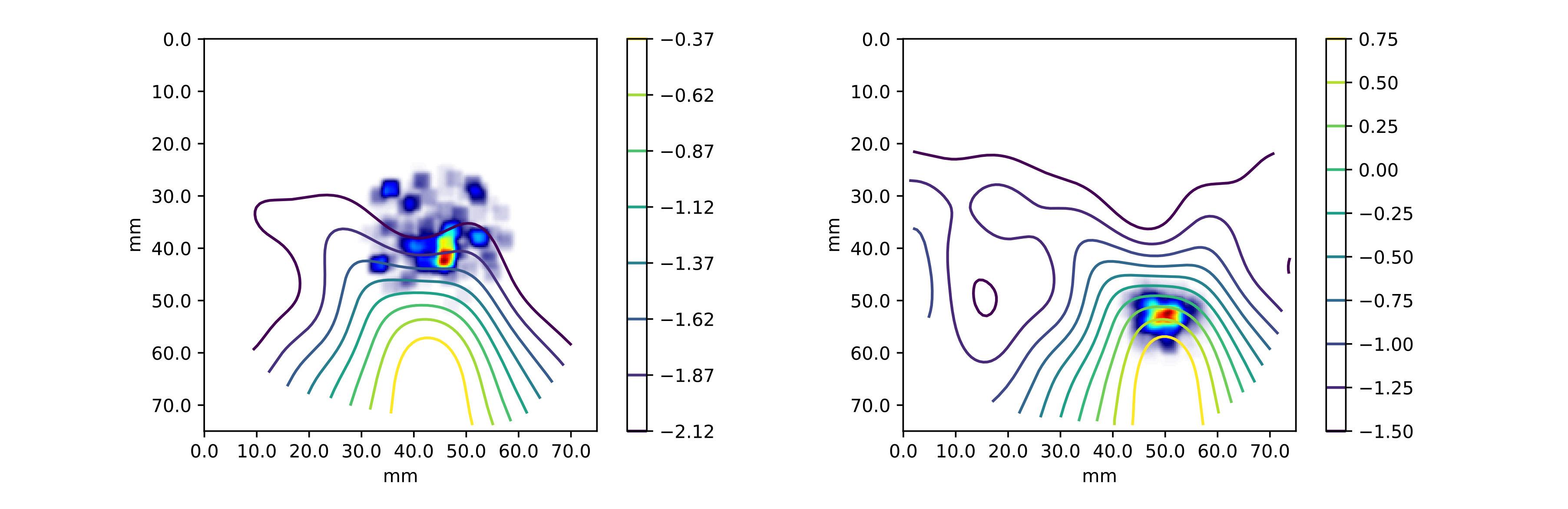 Mapping Vision: Measuring Real Lens Usage with Eye-Tracking